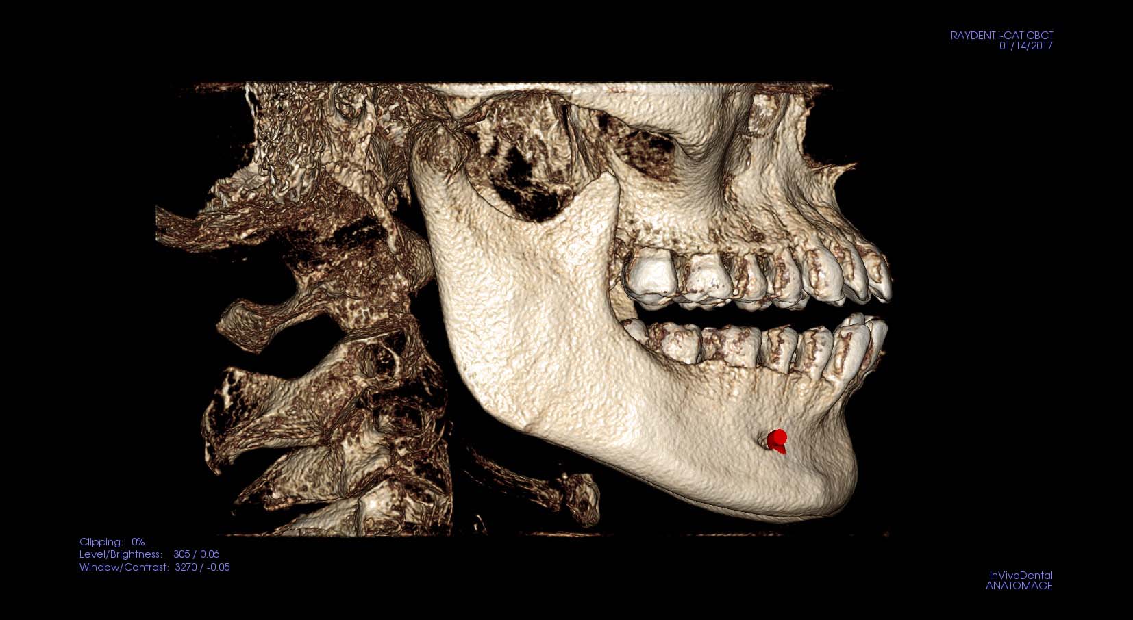 Raydent i-CAT Dental and Maxillofacial Imaging Centre
